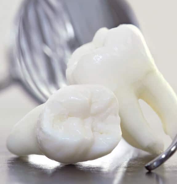 Tooth Extraction Alexandria VA | Alexandria Dental Spa