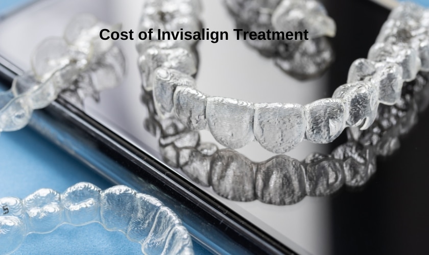 Cost of Invisalign Treatment - Alexandria Dental Spa