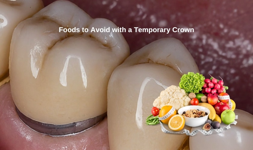 Foods to Avoid with a Temporary Crown